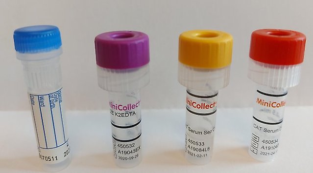 Kapillärprovtagning | Vårdgivarwebb RJH